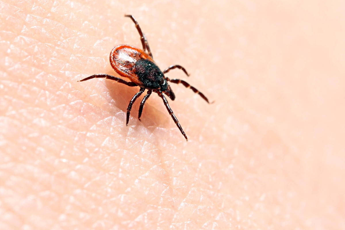 Tick bite – what to do if a tick bites / Mehiläinen